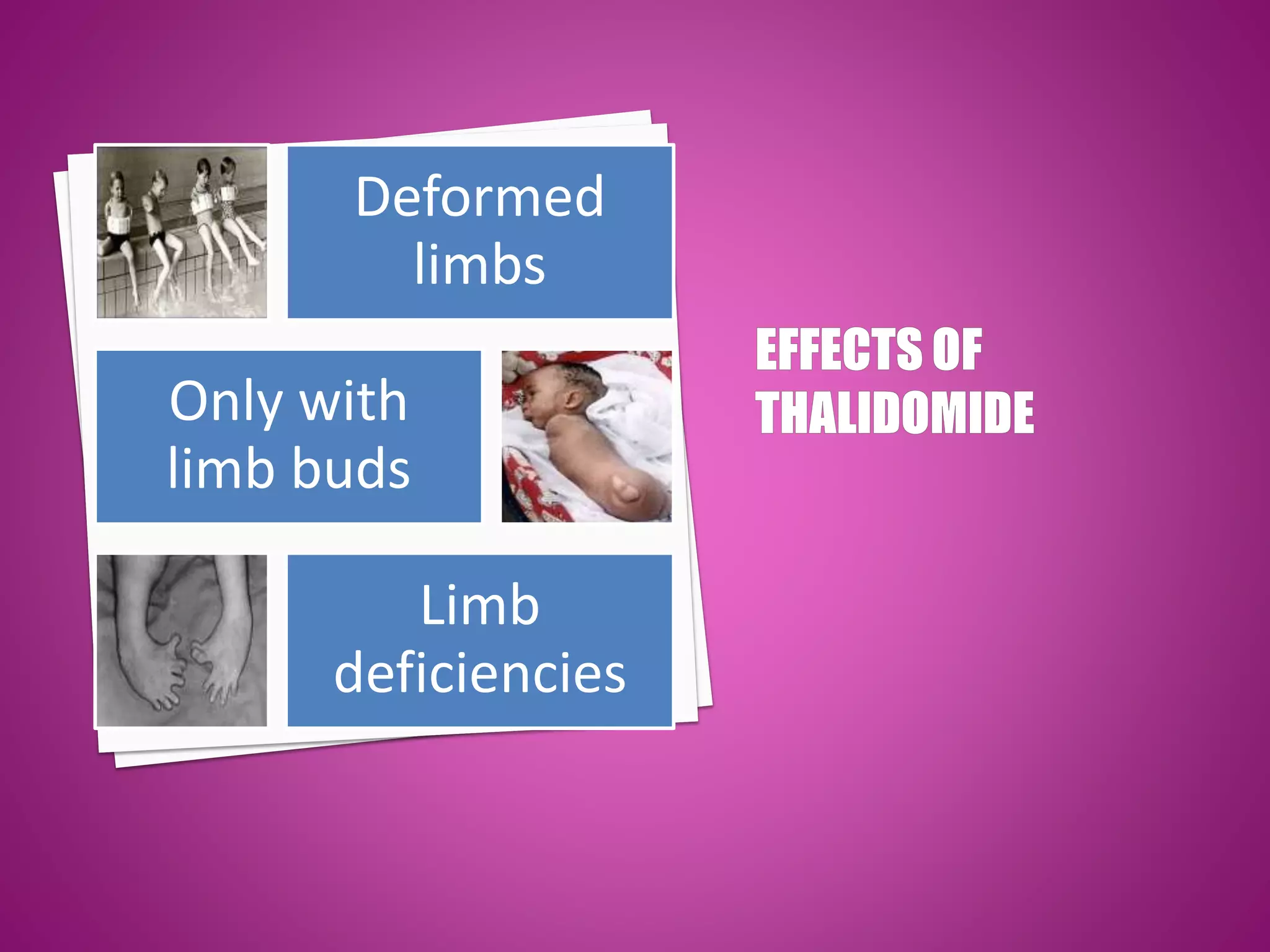 Birth defect due to drugs | PPTX