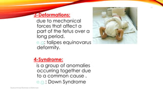 Birth defects | PPTX