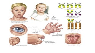 birth defects embryology development 1.pptx