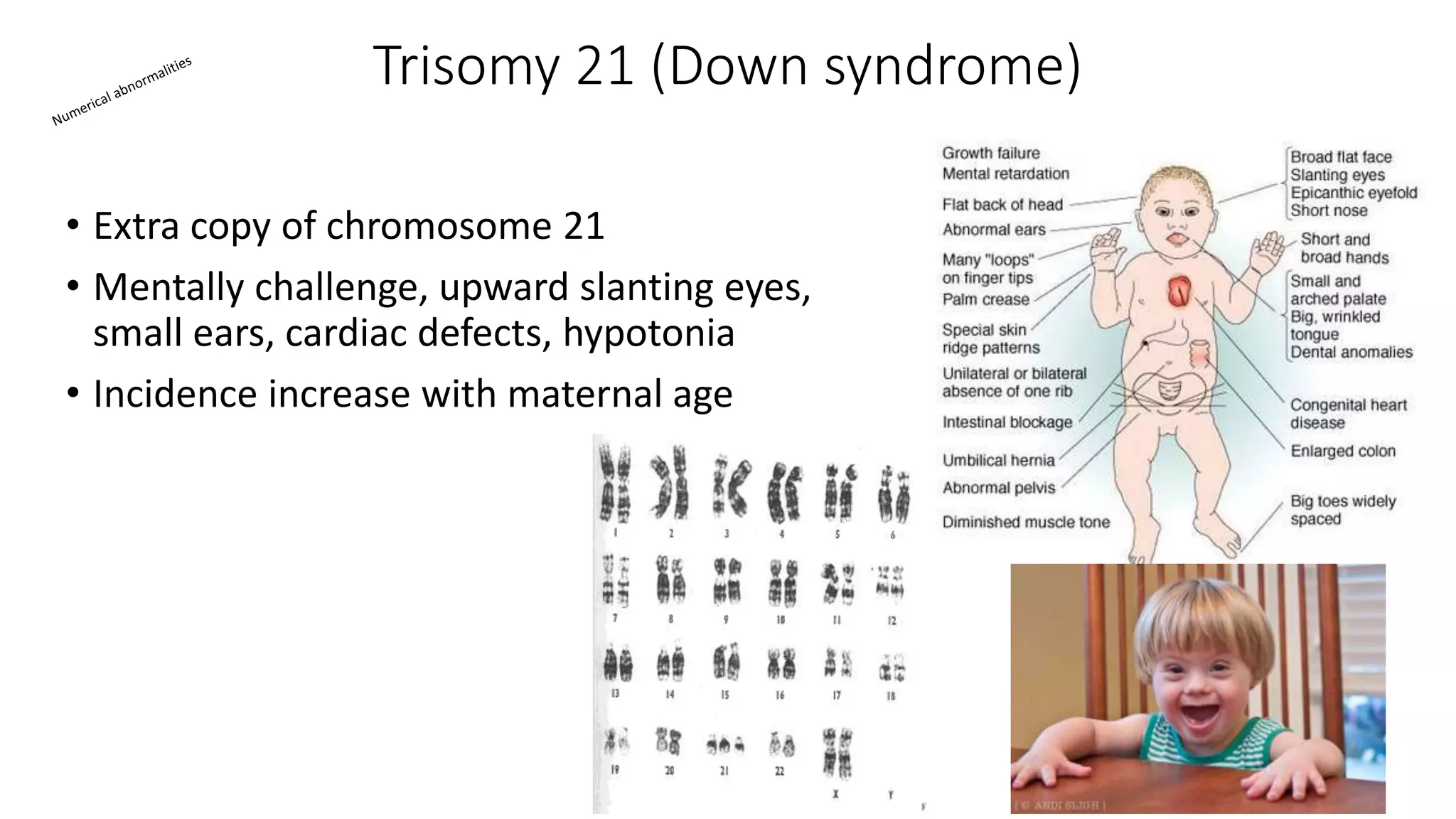 Birth defects and prenatal diagnosis | PPTX