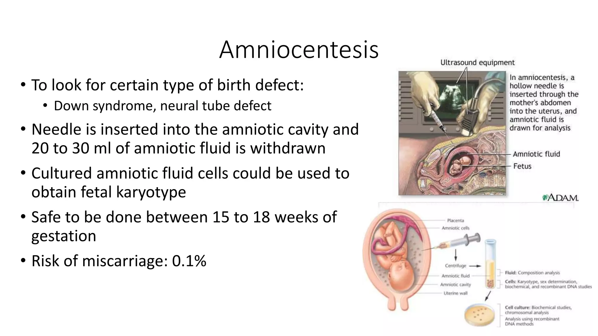 Birth defects and prenatal diagnosis | PPTX