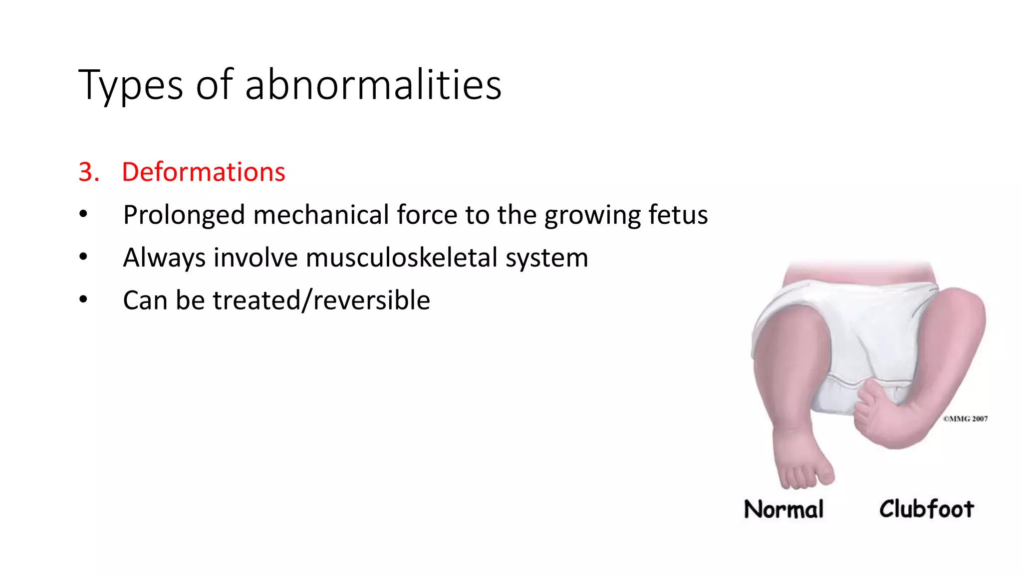 Birth defects and prenatal diagnosis | PPTX