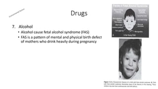 Birth defects and prenatal diagnosis | PPTX