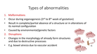 Birth defects and prenatal diagnosis | PPTX