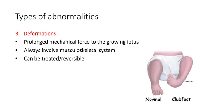 Birth defects and prenatal diagnosis | PPTX | Pregnancy | Reproductive ...