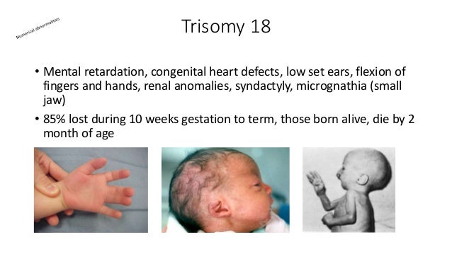 Birth defects and prenatal diagnosis