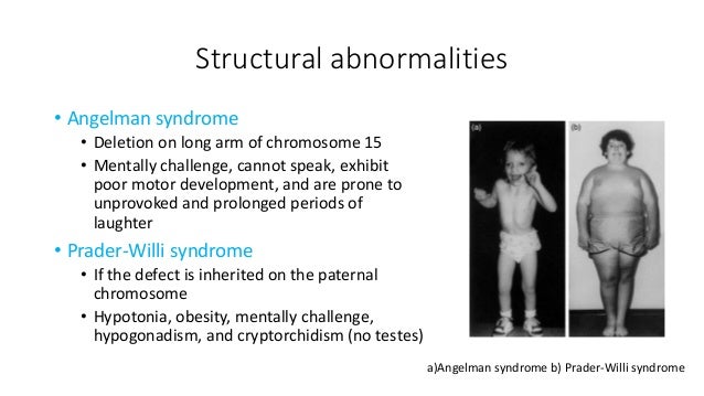 Birth Defects And Prenatal Diagnosis
