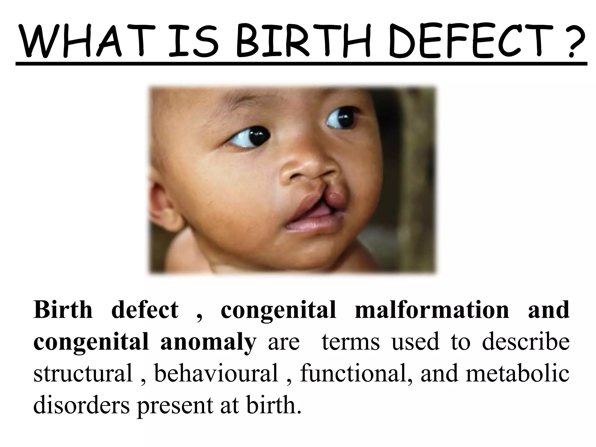 Birth defects | PPTX