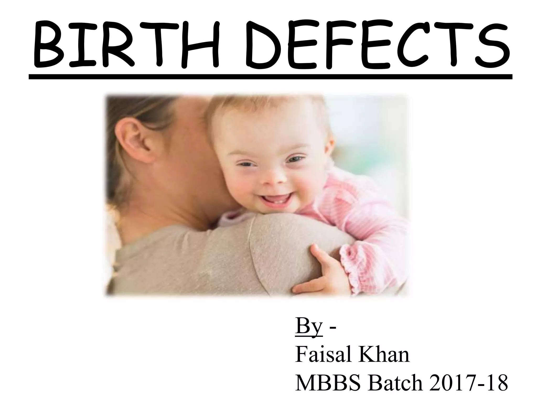 Birth defects | PPT