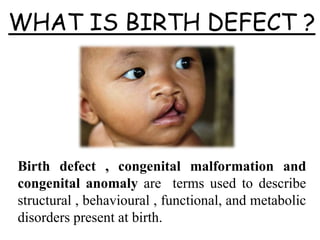 Birth defects | PPTX