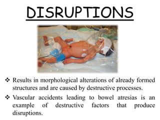 Birth defects | PPTX
