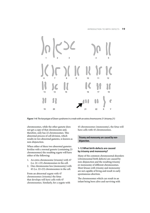 Birth Defects: Introduction to birth defects | PDF