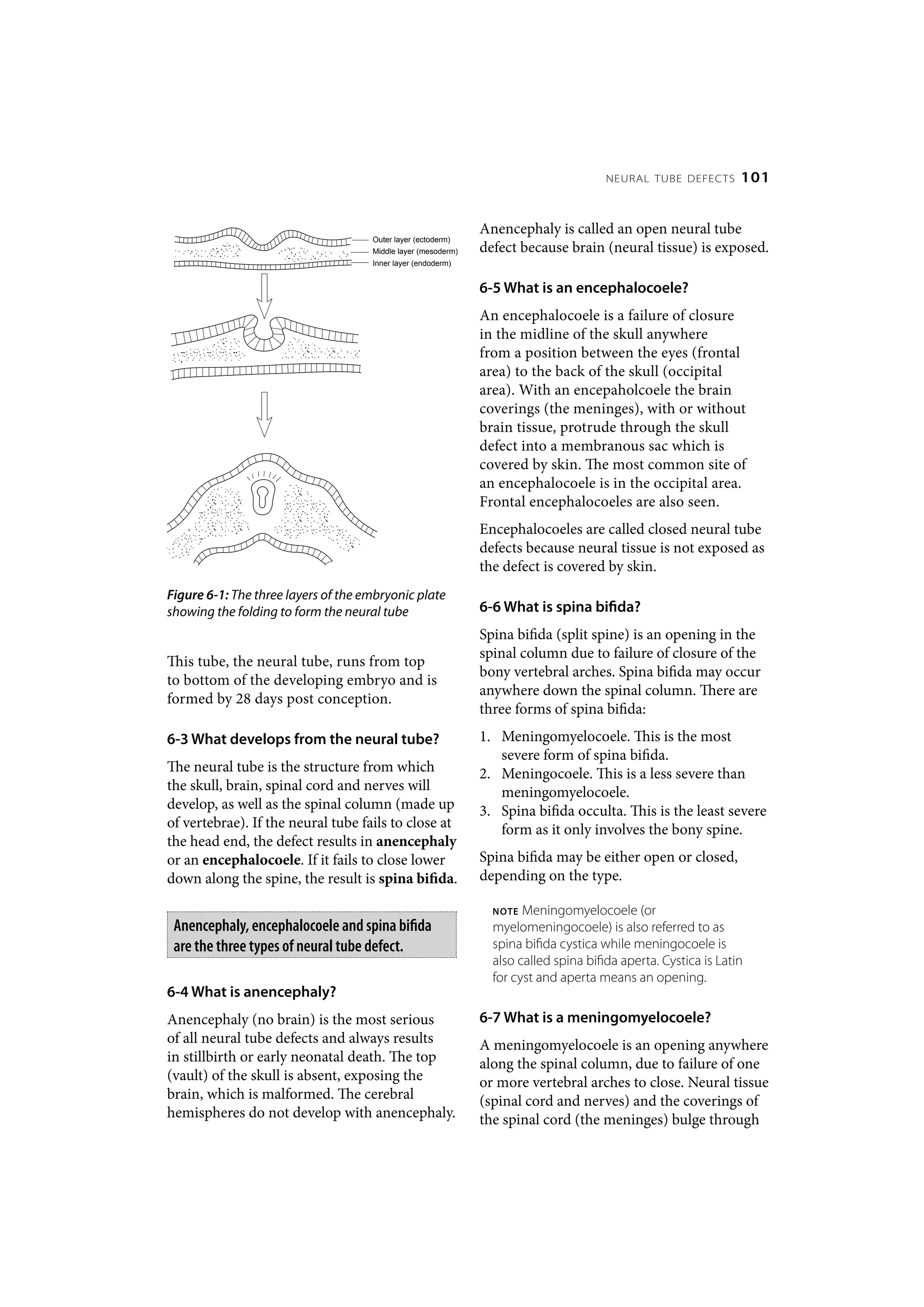 Birth Defects: Neural tube defects | PDF
