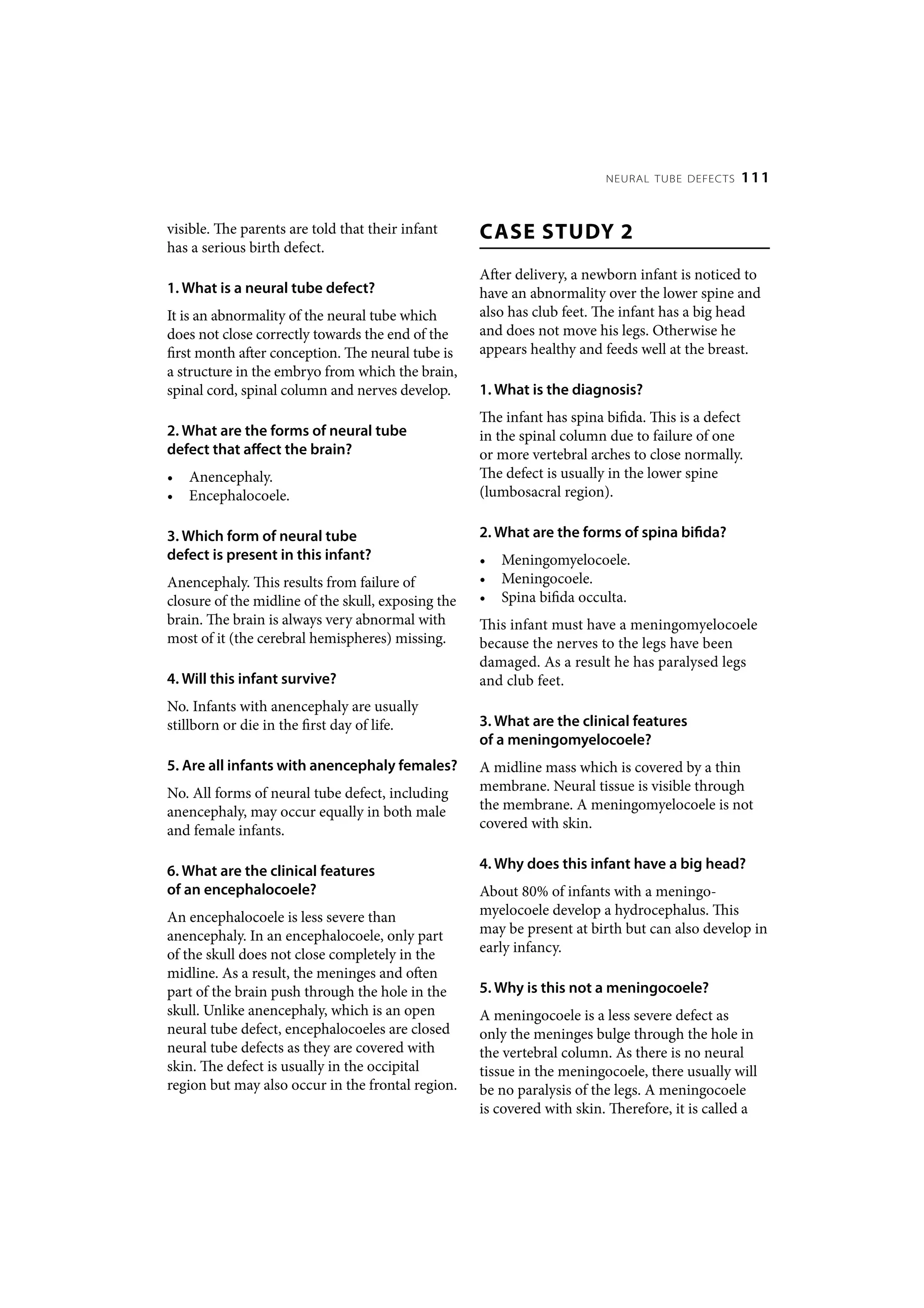 Birth Defects: Neural tube defects | PDF