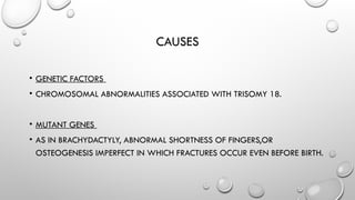 BIRTH DEFECTS OF LIMBS by Dr. Rabia Inam Gandapore.pptx