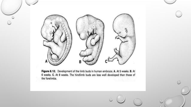 BIRTH DEFECTS OF LIMBS by Dr. Rabia Inam Gandapore.pptx