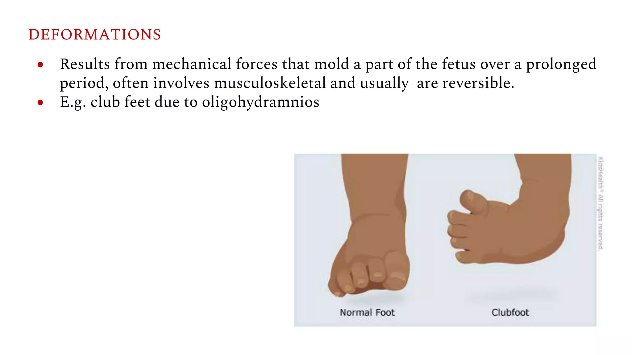 Birth defects & prenatal diagnosis by dr. omar nouri | PPT