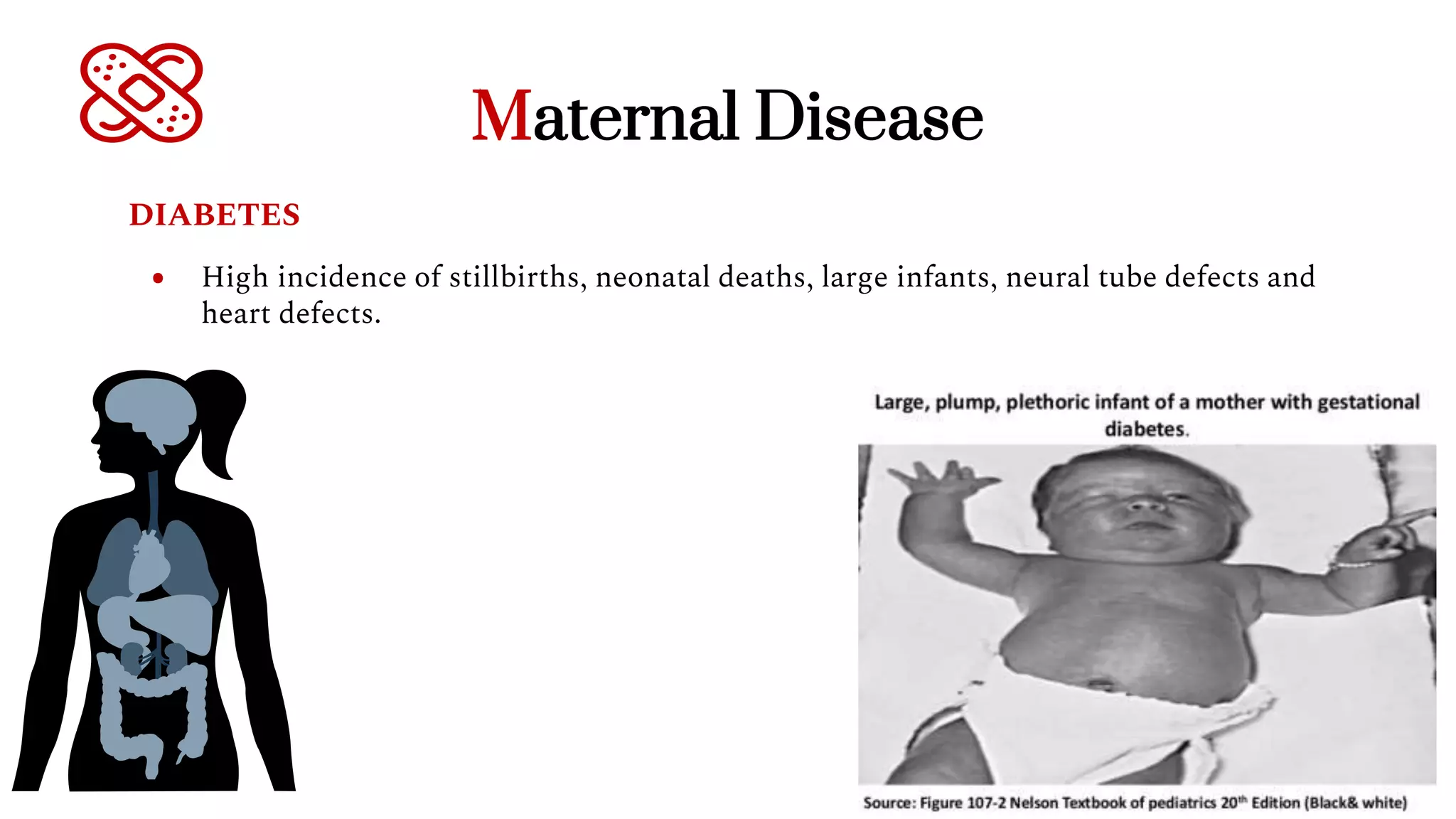 Birth defects & prenatal diagnosis by dr. omar nouri | PPT