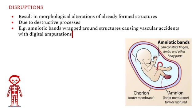 Birth defects & prenatal diagnosis by dr. omar nouri | PPT