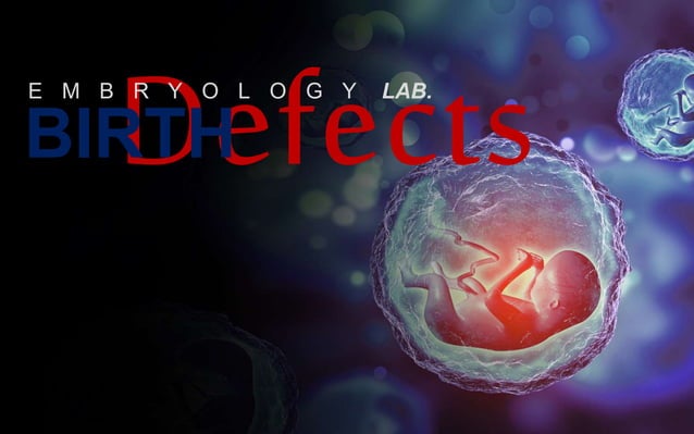Birth Defects | PPTX
