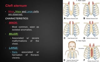 Birth Defects | PPTX