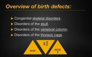 Birth Defects | PPTX