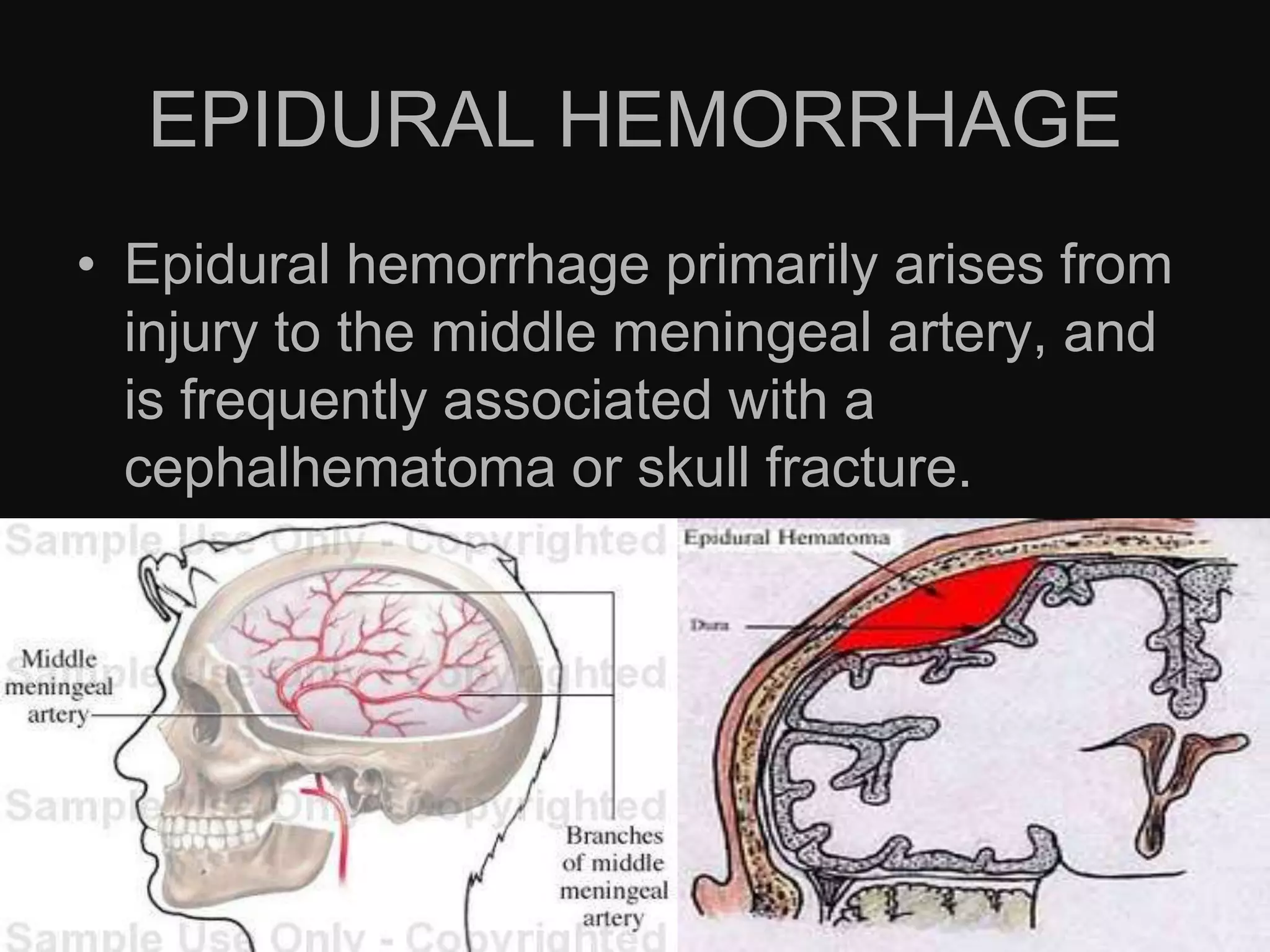 Birth injuries | PPTX