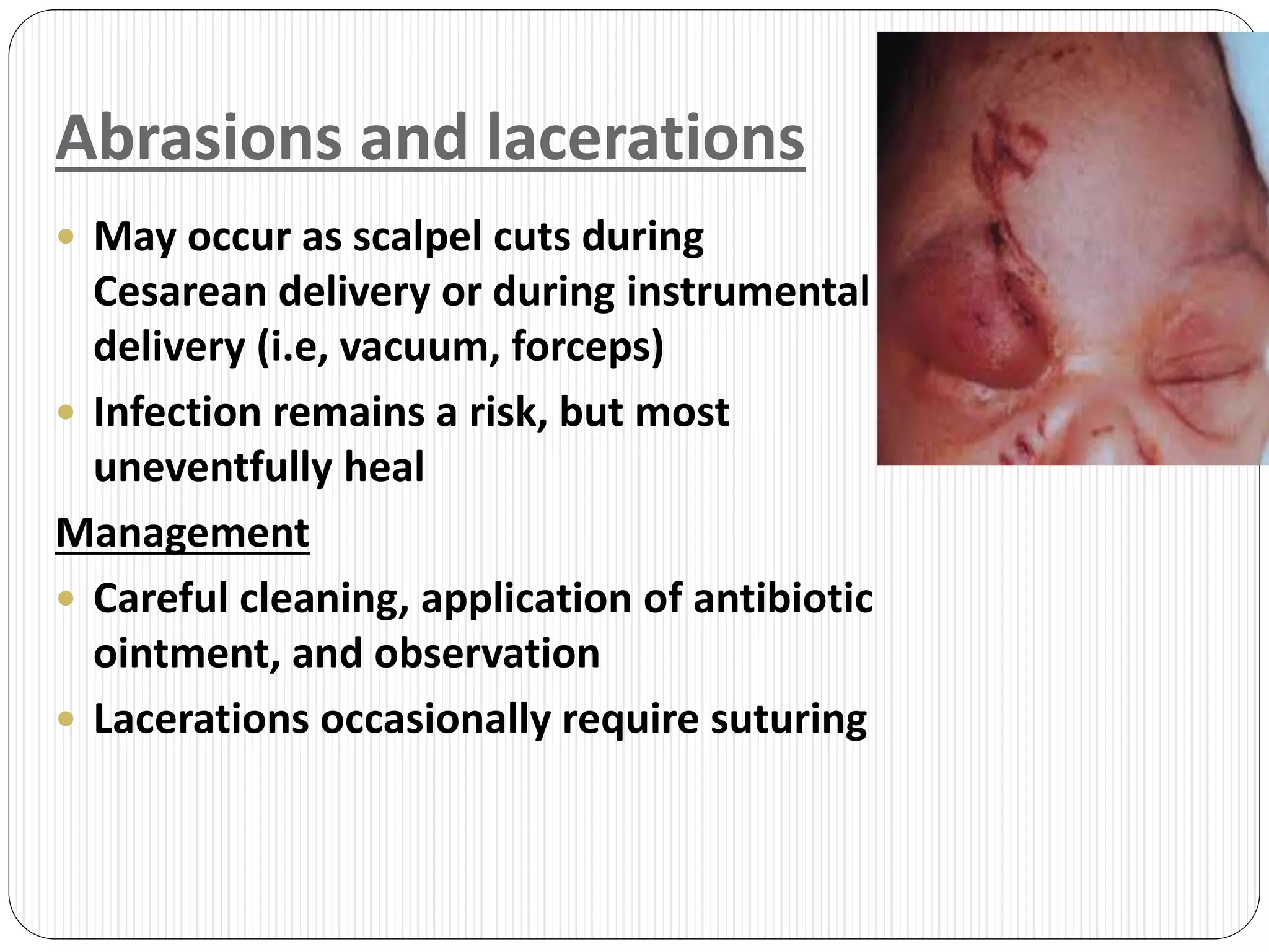 Birth injuries | PPTX