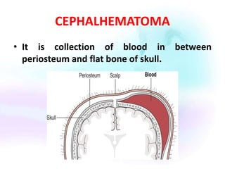 Birth injuries | PPTX
