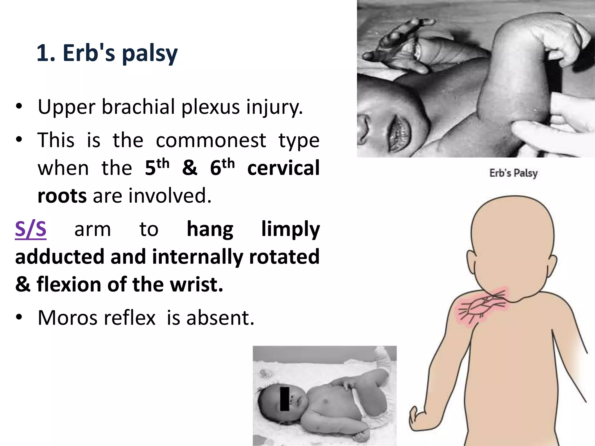 BIRTH INJURIES IN NEWBORN | PPTX