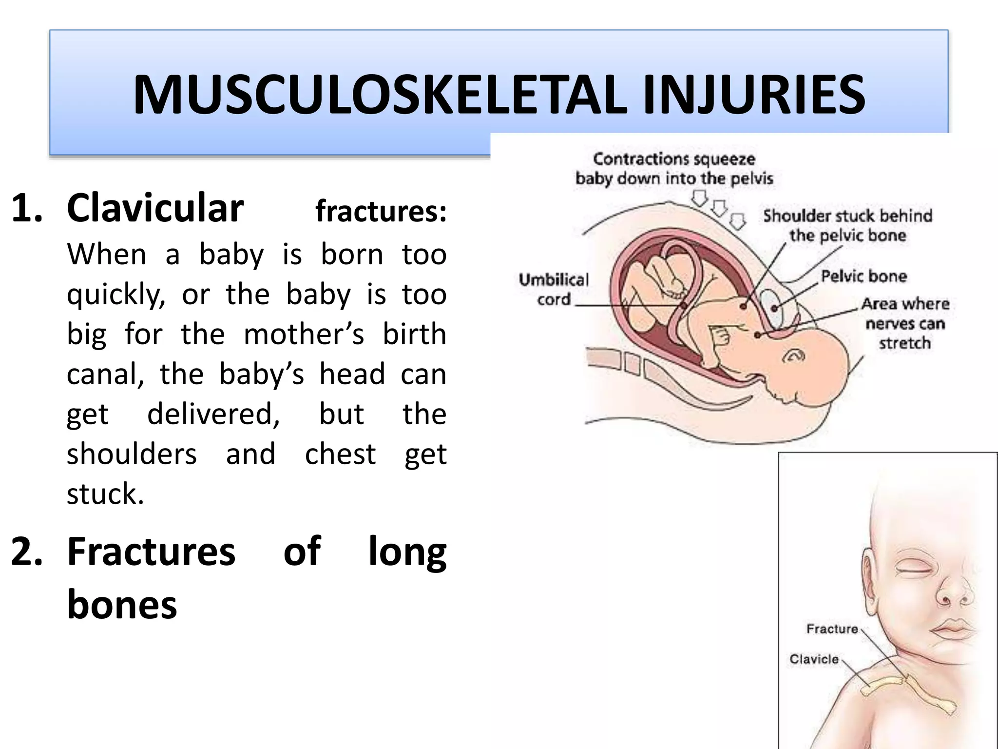 BIRTH INJURIES IN NEWBORN | PPTX