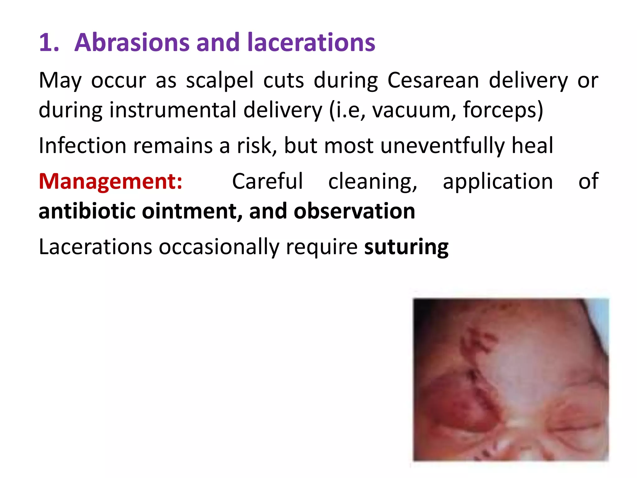 BIRTH INJURIES IN NEWBORN | PPTX