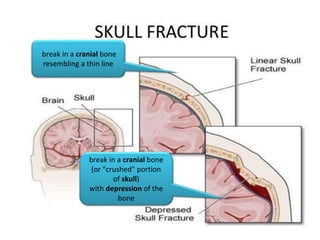 BIRTH INJURIES IN NEWBORN | PPTX
