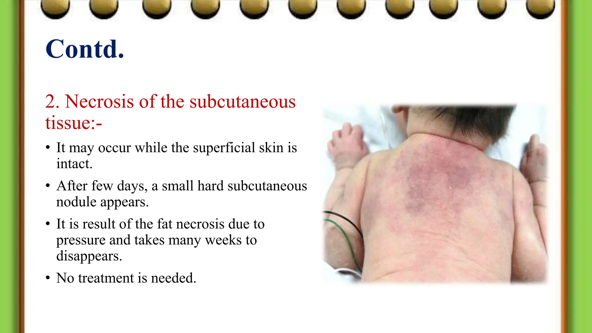 birth injuries. by Preeti Kulshrestha MSc. nursing final year pptx | PPT