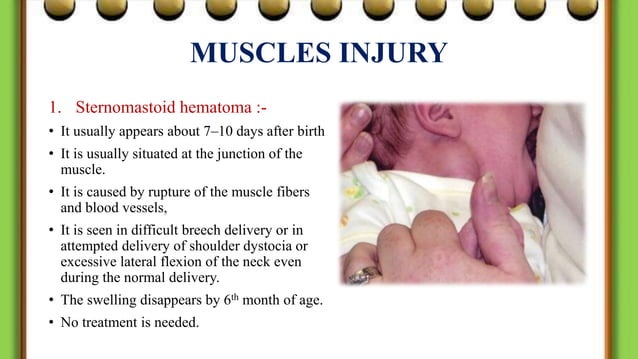 birth injuries. by Preeti Kulshrestha MSc. nursing final year pptx | PPT