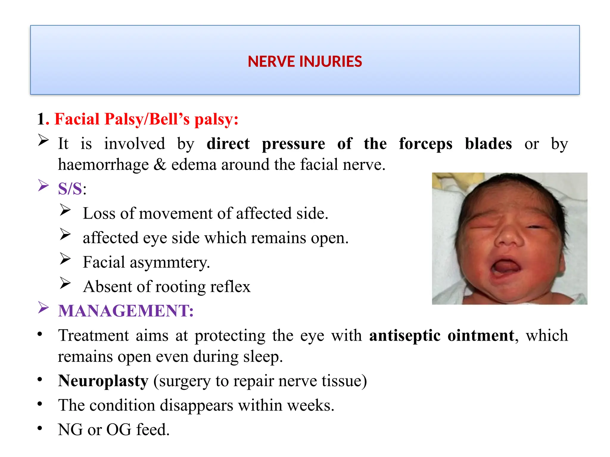 Birth Injuries are the main common problem faced by newborn while ...