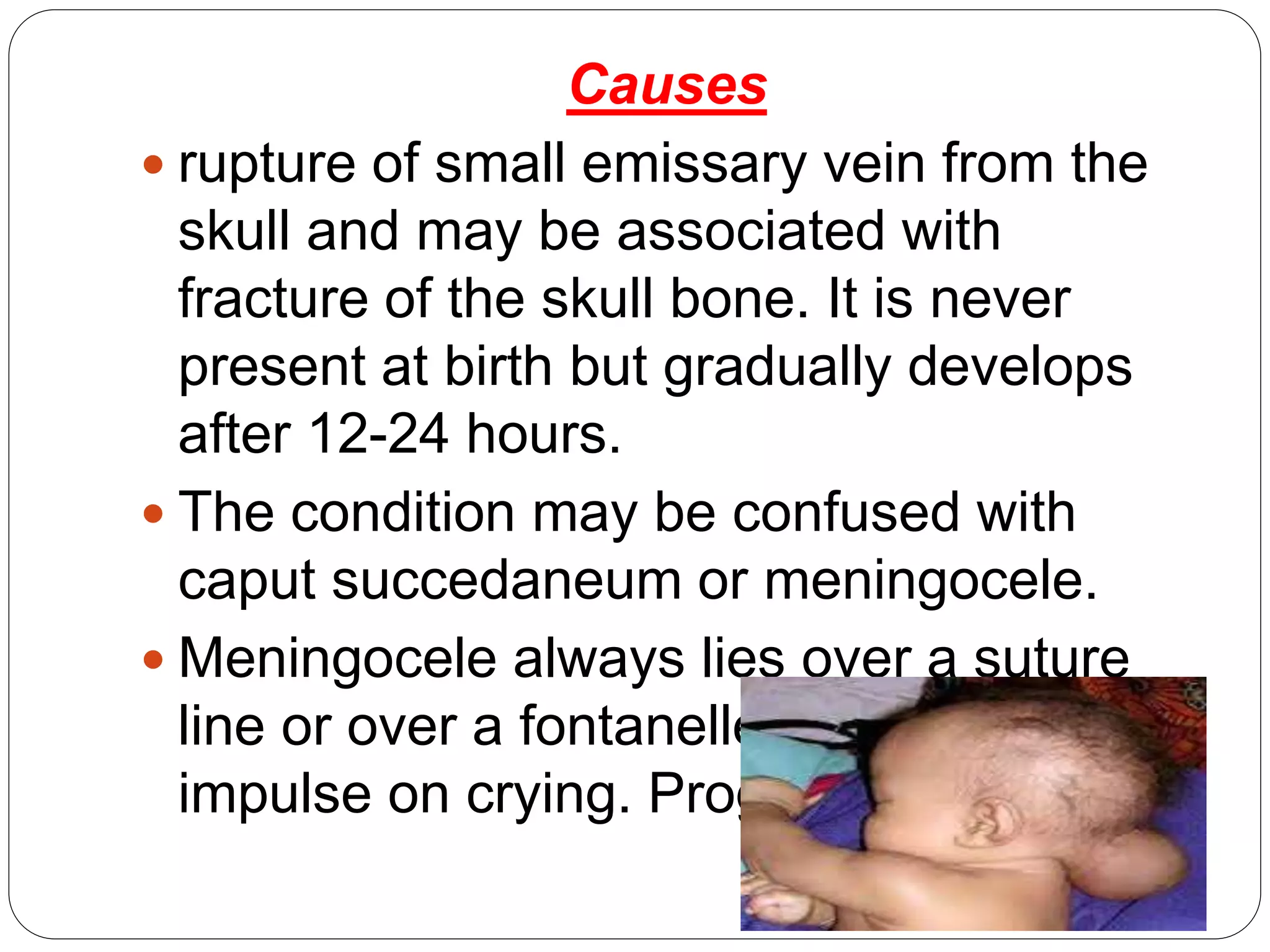 Birth injuries and icterus neonatarum | PPTX