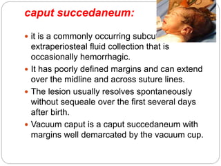 Birthinjuriesandicterusneonatarum | PPT