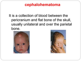 Birthinjuriesandicterusneonatarum | PPT