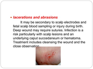 Birthinjuriesandicterusneonatarum | PPT