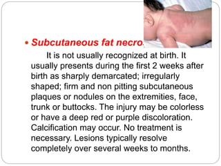 Birthinjuriesandicterusneonatarum | PPT