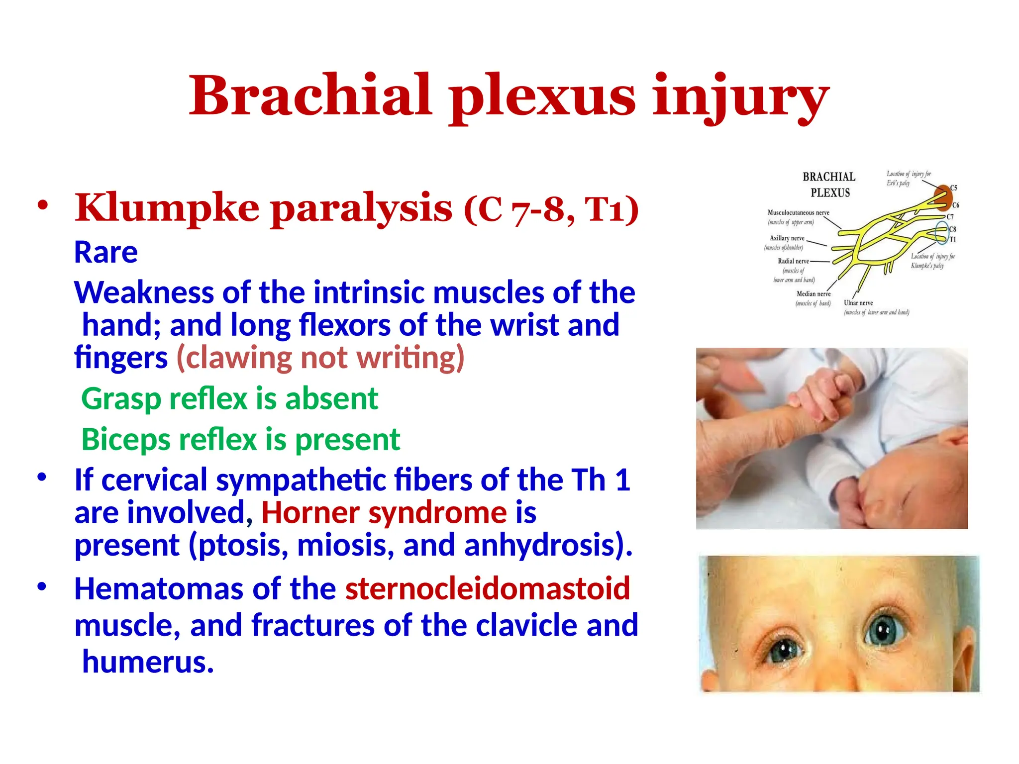 Birth Injuries OF THE BRACHIAL PLEXUS Dr. Ayman Awlia.pptx