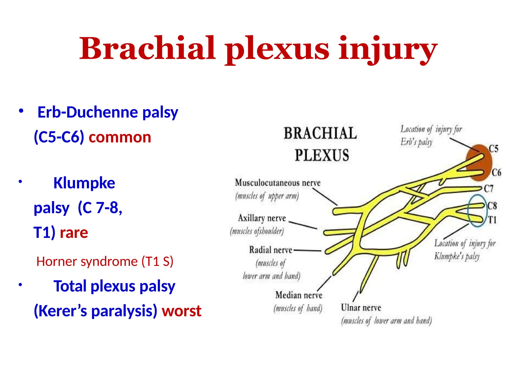 Birth Injuries OF THE BRACHIAL PLEXUS Dr. Ayman Awlia.pptx