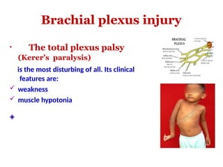 Birth Injuries OF THE BRACHIAL PLEXUS Dr. Ayman Awlia.pptx
