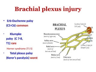 Birth Injuries OF THE BRACHIAL PLEXUS Dr. Ayman Awlia.pptx