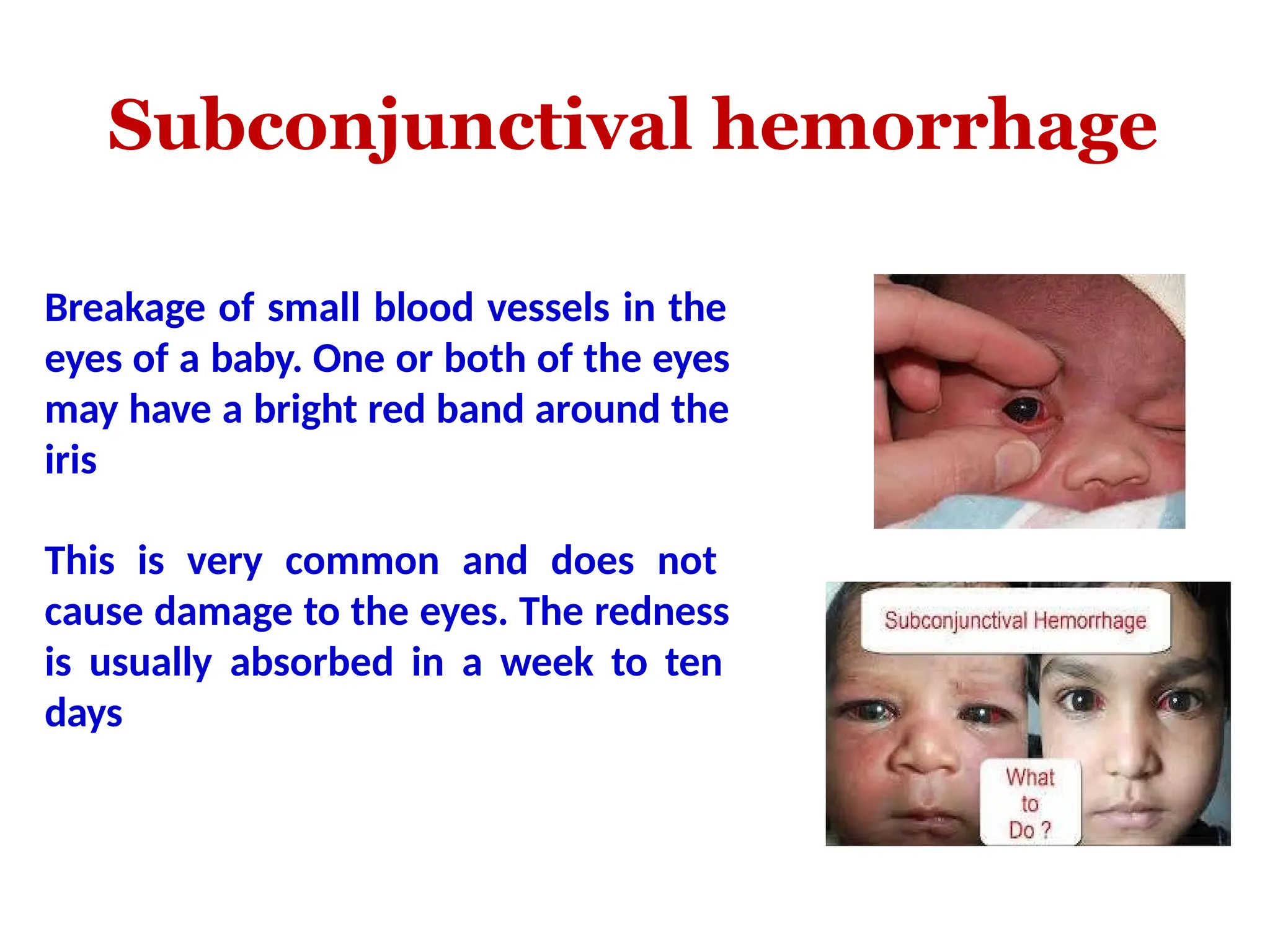 common Birth Injuries ppt in neonates .pptx