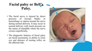 BIRTH INJURY.pptx