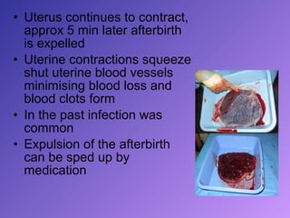 Birth (parturition) | PPT