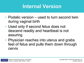 Birth related procedures 10 | PPT