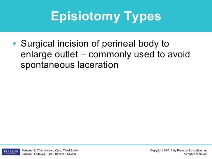 Birth related procedures 10 Birth related procedures 10